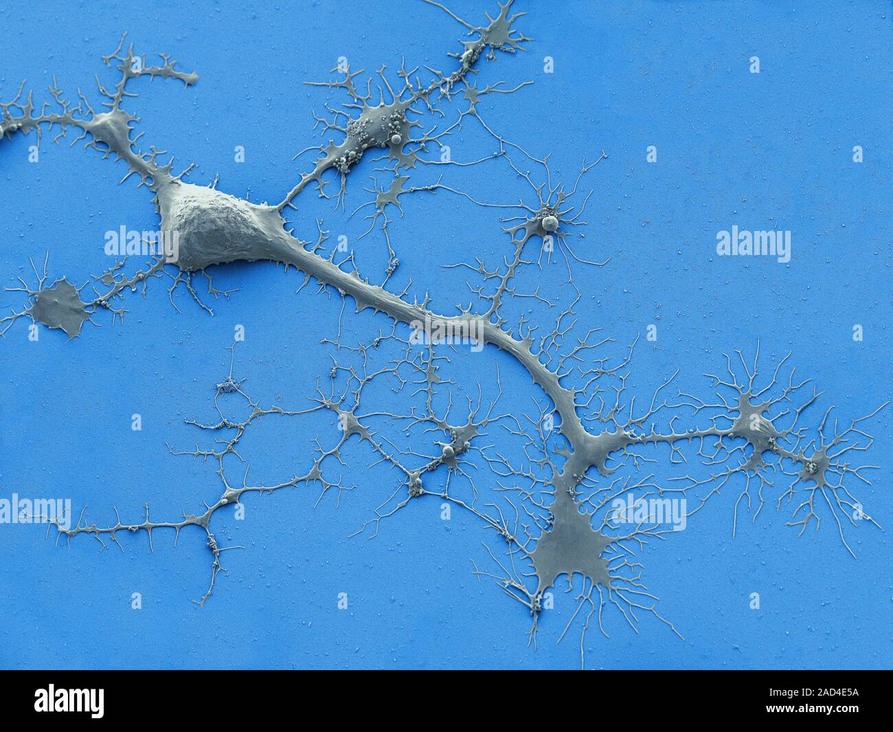 Stem cell-derived neuron. Coloured scanning electron micrograph (SEM ...