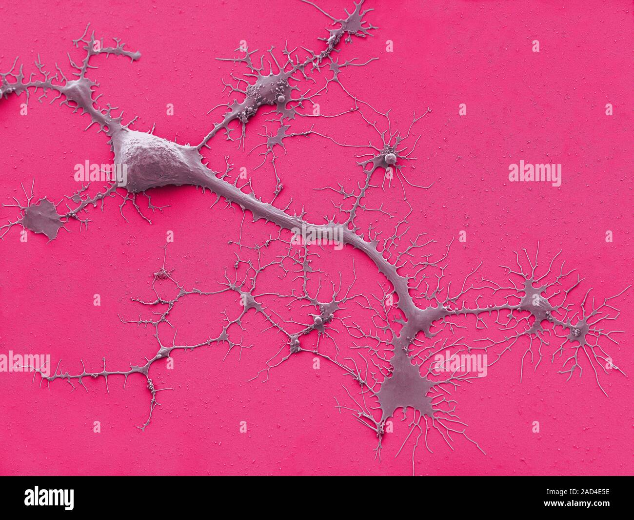 Stem cell-derived neuron. Coloured scanning electron micrograph (SEM ...