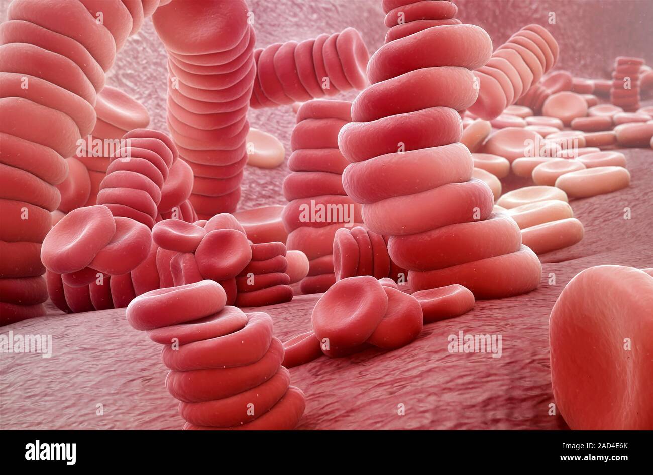Red blood cell rouleaux. Computer illustration of stacks (rouleaux) of ...