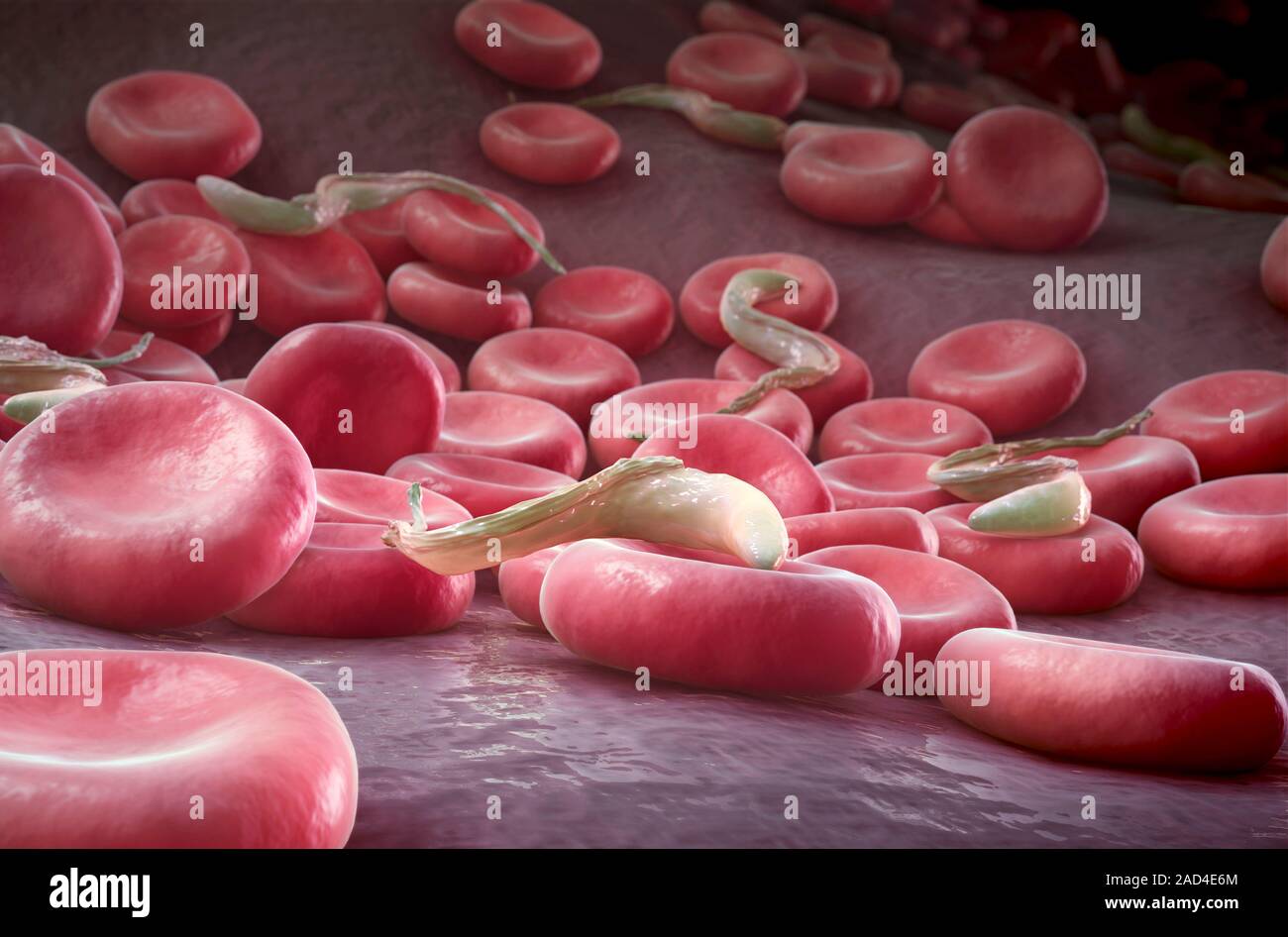 Sleeping sickness parasites. Computer illustration of Trypanosoma ...