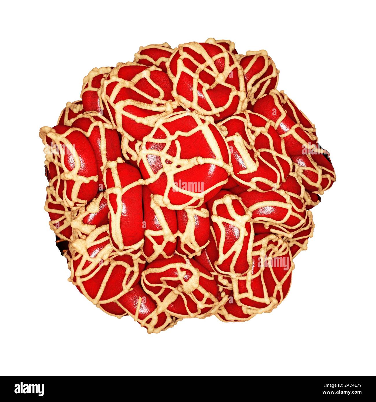 Blood clot. Computer artwork of red blood cells (erythrocytes) trapped ...