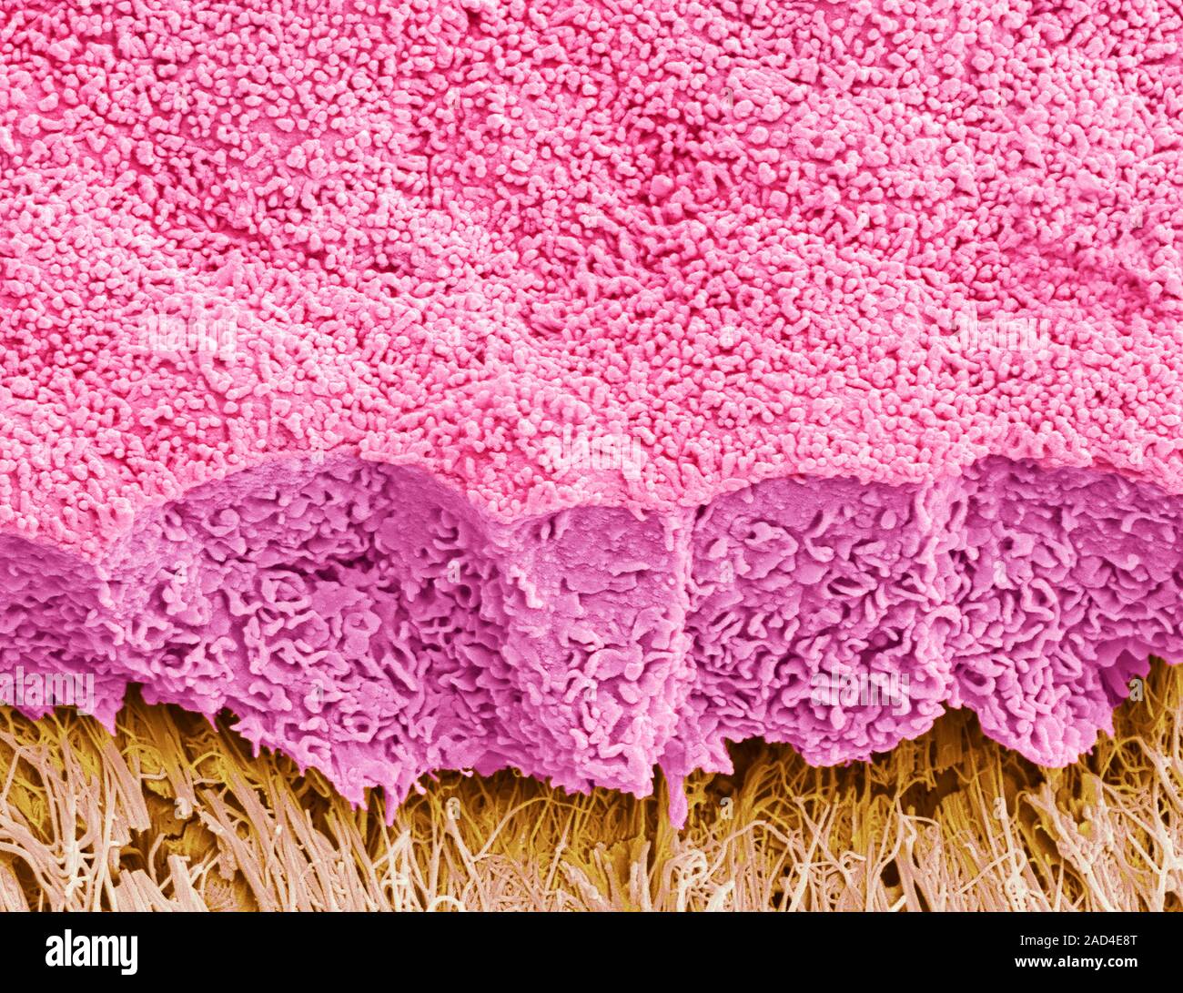 Gall bladder. Coloured scanning electron micrograph (SEM) of the ...