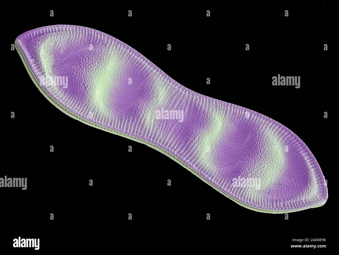 Diatom. Coloured scanning electron micrograph (SEM) of a single diatom ...