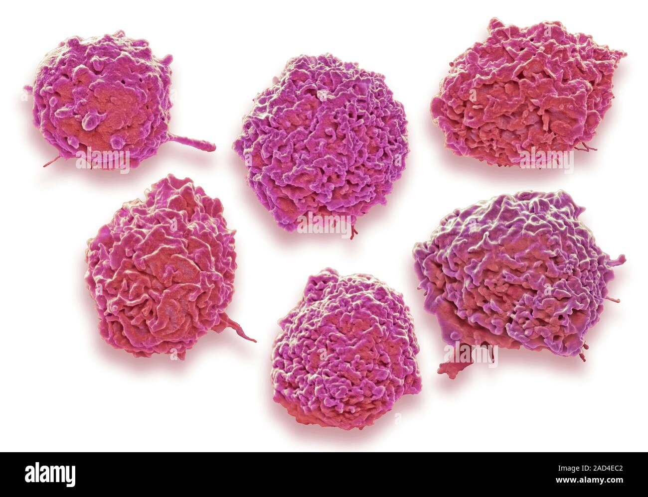 Pus. Coloured scanning electron micrograph (SEM) of a collection of ...