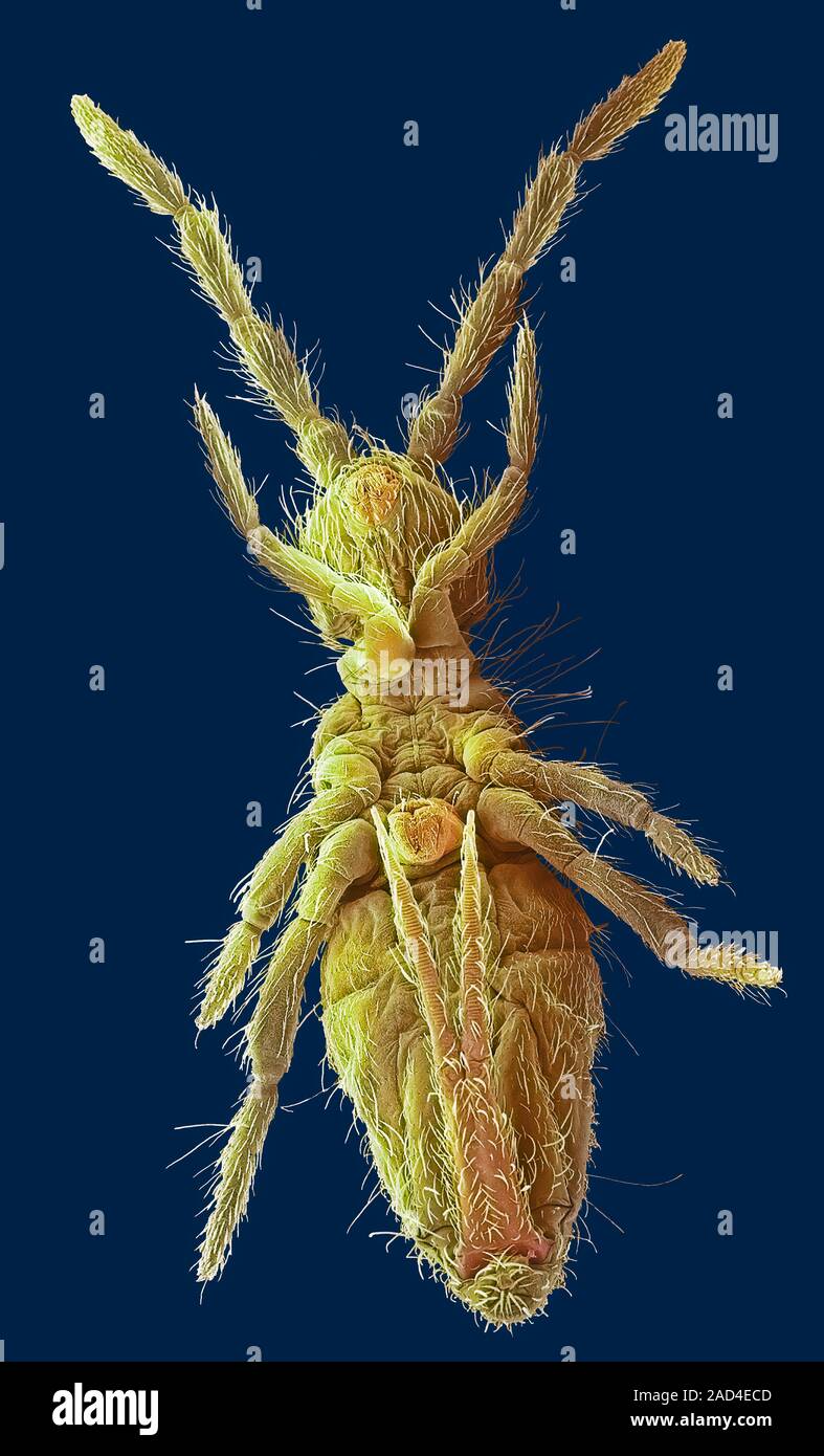 Springtail. Coloured scanning electron micrograph (SEM) of a springtail ...