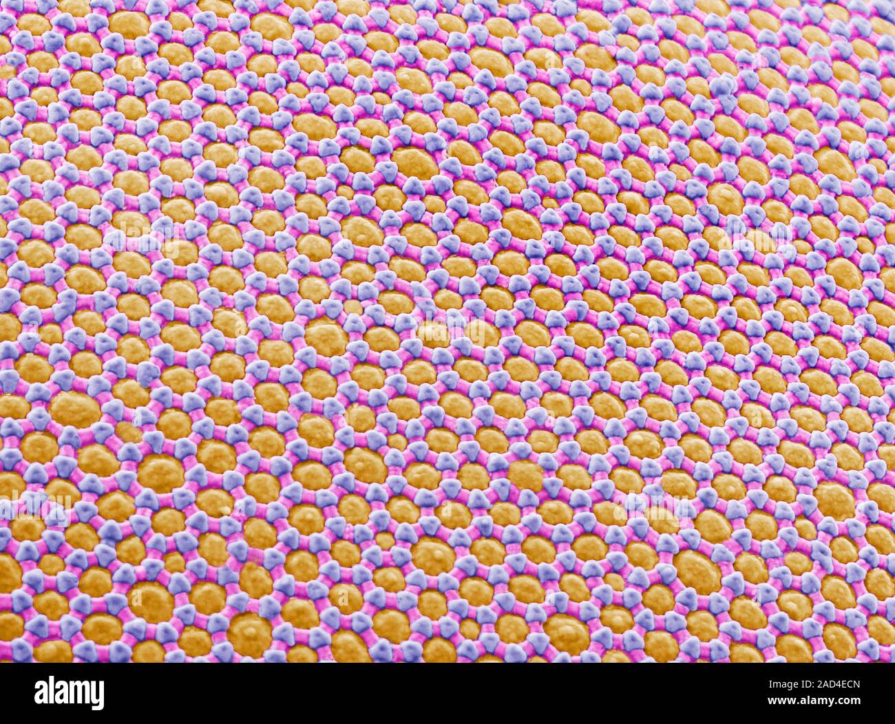 Springtail body, coloured scanning electron micrograph (SEM ...