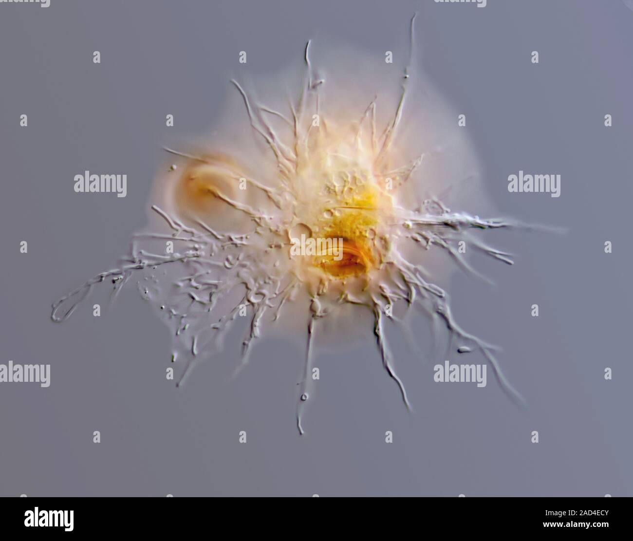 Light micrograph of a living Diaphoropodon sp. amoeba, showing the huge ...