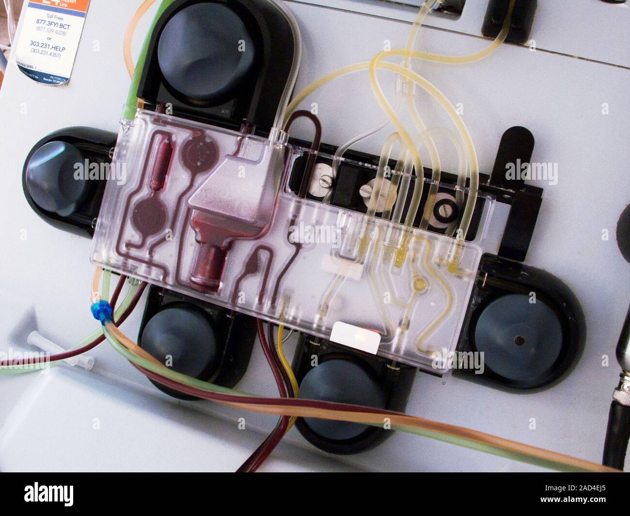 Plasmapheresis machine in use. Close-up of a plasmapheresis machine ...