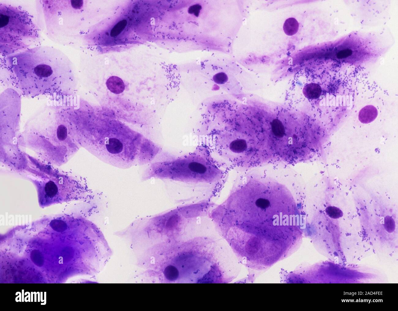 Light microscopy of human oral cavity epithelial cells (purple) with ...