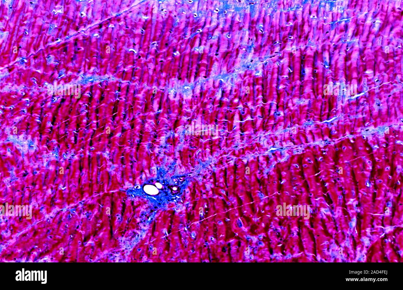 Light microscopy of a ligament viewed with light microscopy. Bundles of ...