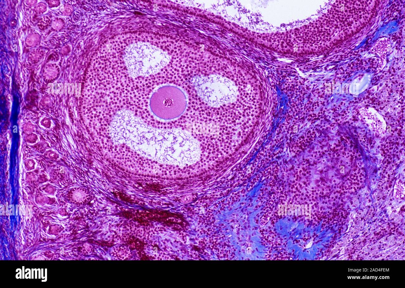 Light microscopy of a growing antral or secondary ovarian follicle. The ...