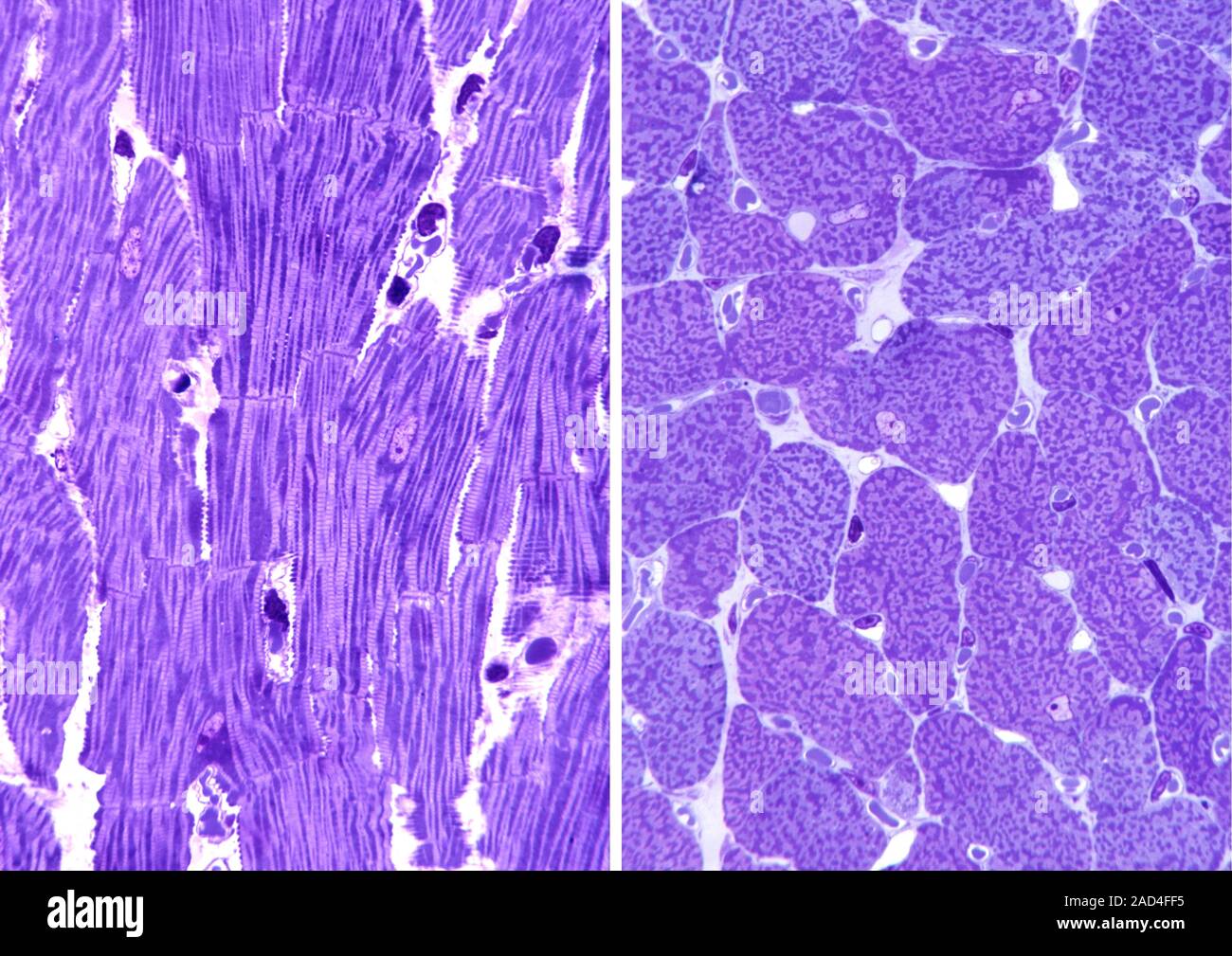 Light microscopy of cardiac (heart) muscle seen at left in longitudinal ...