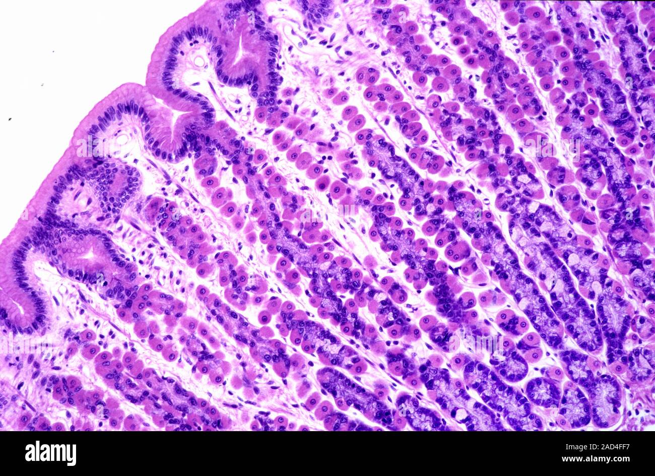 Light microscopy of the epithelial lining of the stomach also called ...