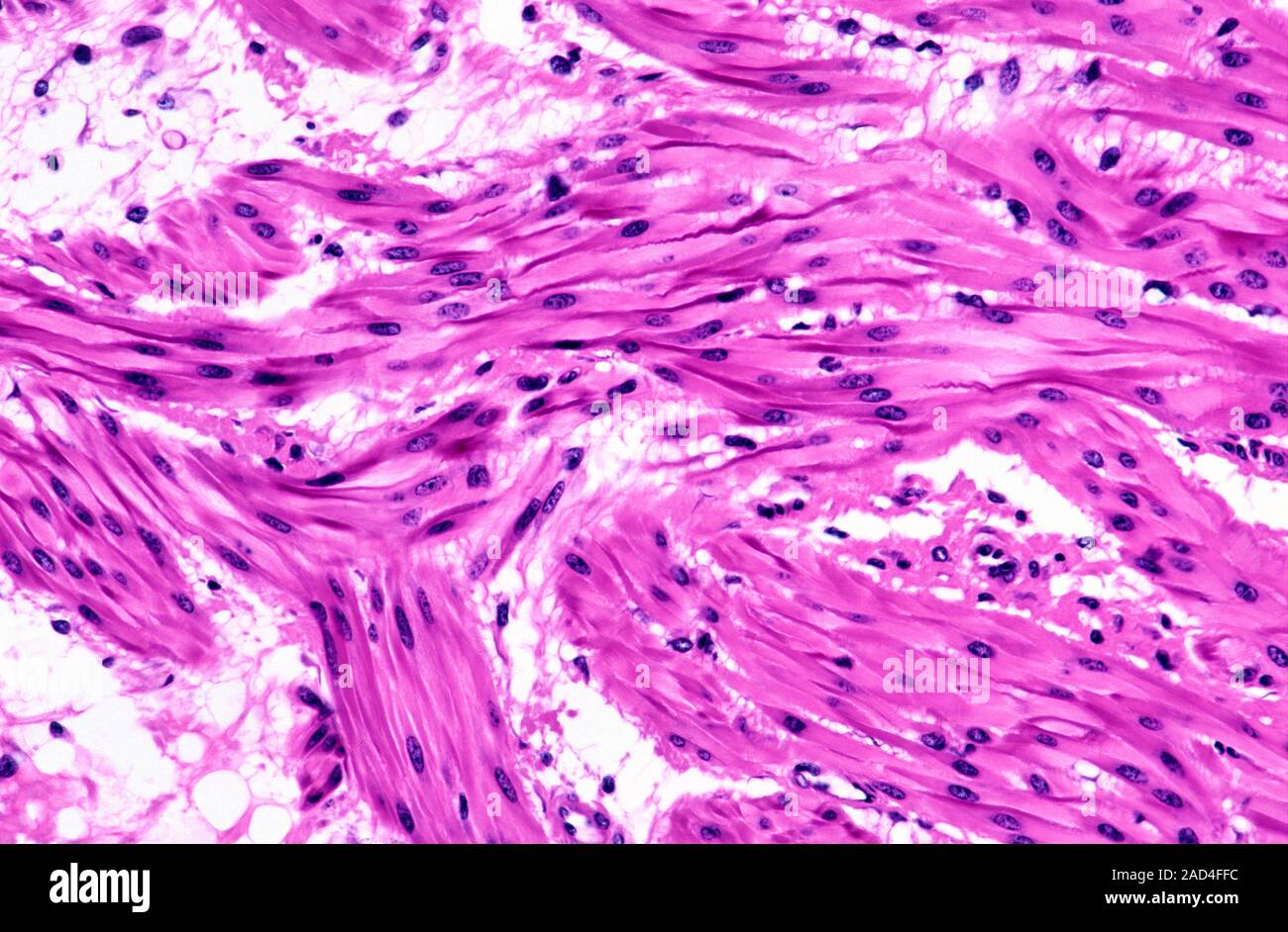 Light microscopy of smooth muscle cells typically slender, tapering and ...