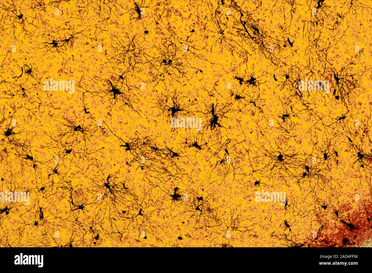 Light microscopy of brain gray matter showing neurons stained black ...