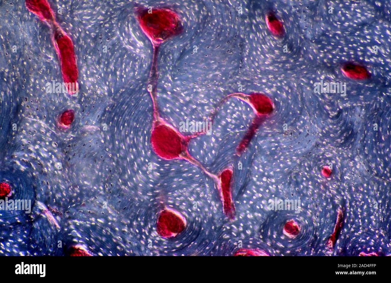 Light microscopy of compact/adult unstained bone tissue seen by ...