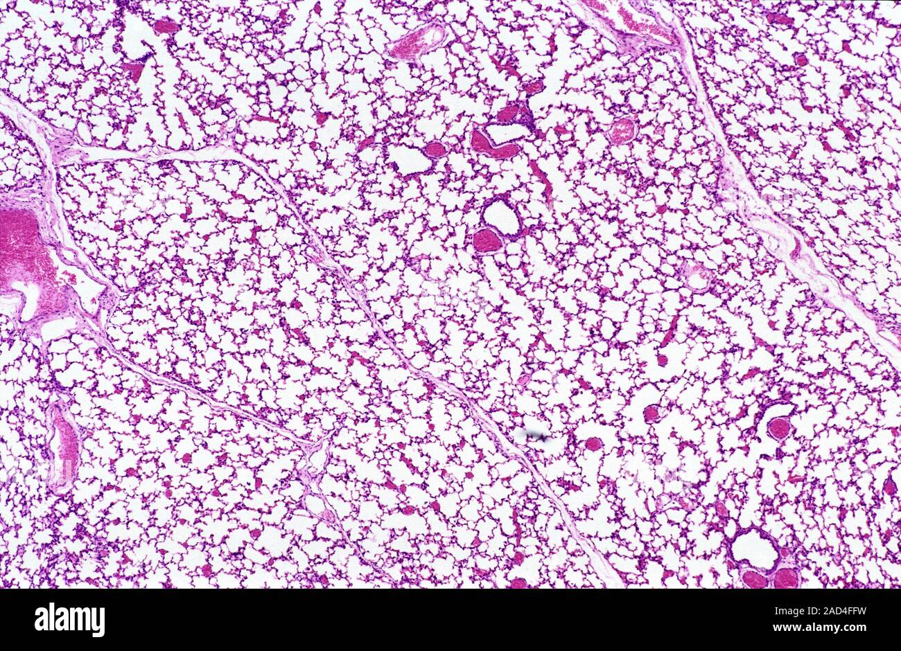 Light microscopy of lung tissue showing very many alveoli. Each ...