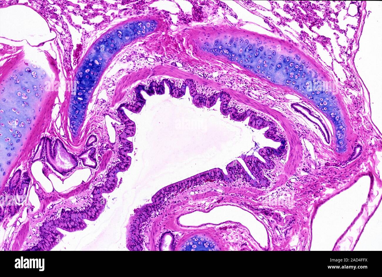 Light microscopy of lung tissue showing a bronchus. As a major ...