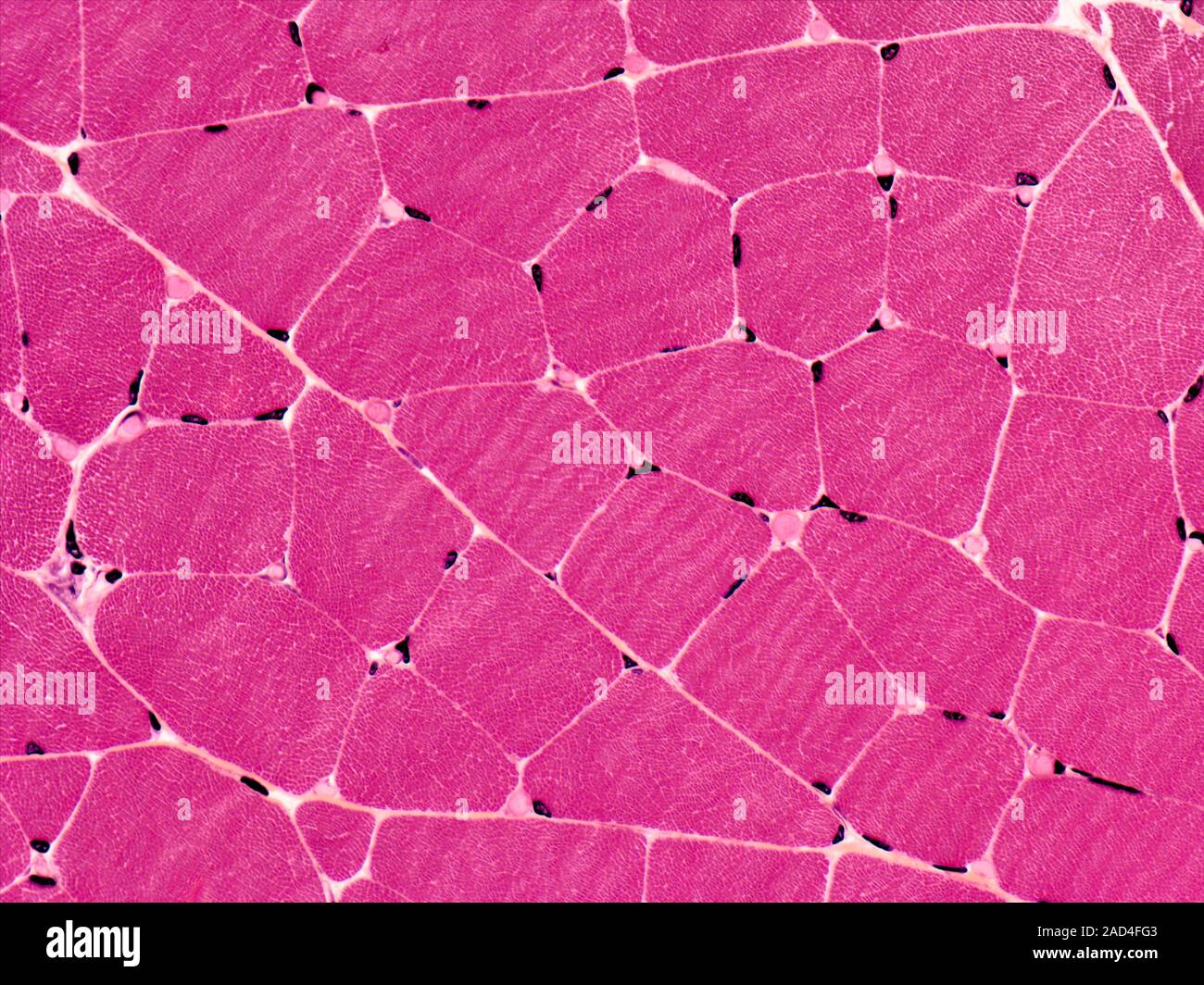 Light microscopy of skeletal muscle fibres seen in cross section and ...