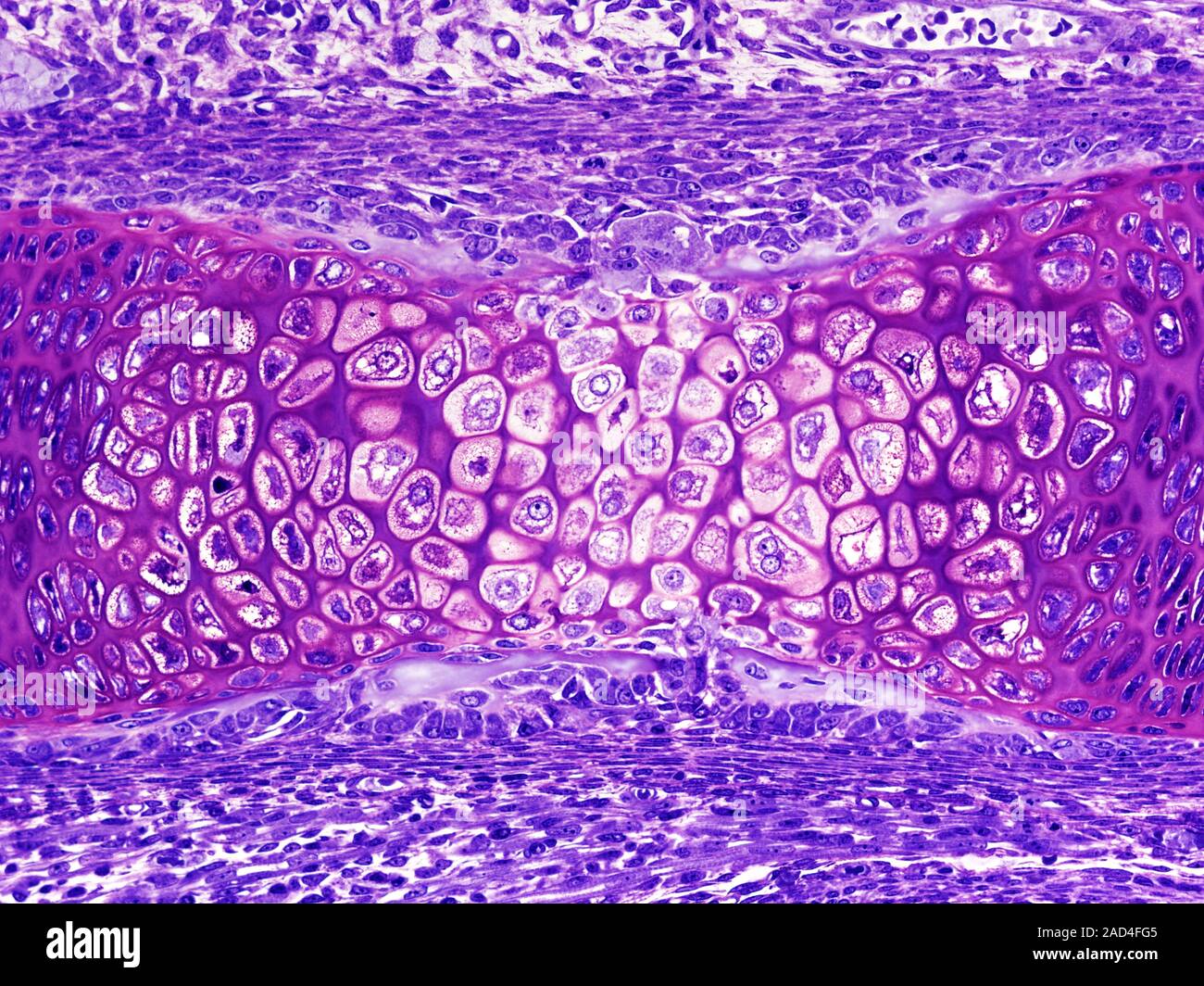 Light microscopy of a longitudinal section through a fetal finger. At ...