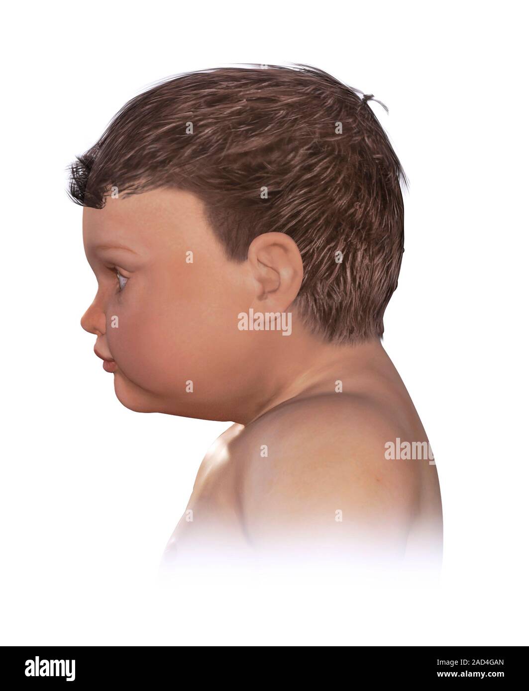 Normal head size in newborn. Computer illustration showing the normal ...