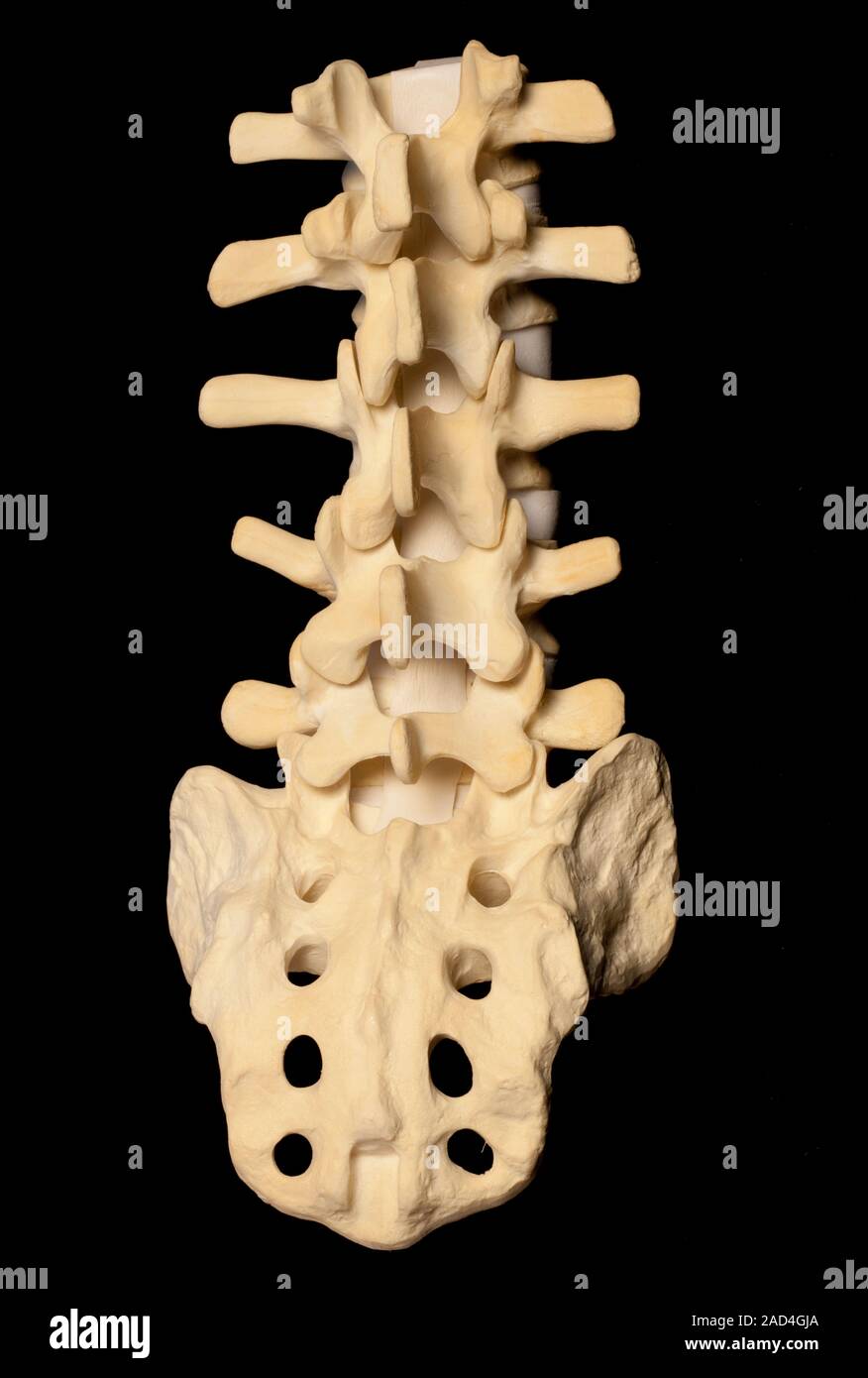 3D printed anatomical lower spine model. Example of an object produced ...
