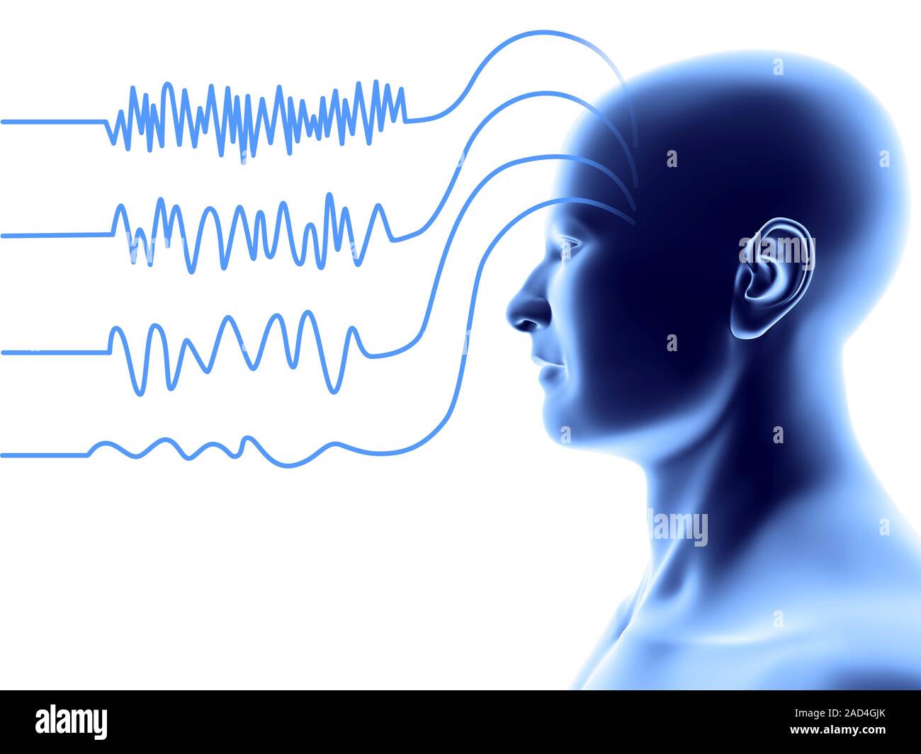 Neurofeedback (NFB), also called neurotherapy or neurobiofeedback, is a ...