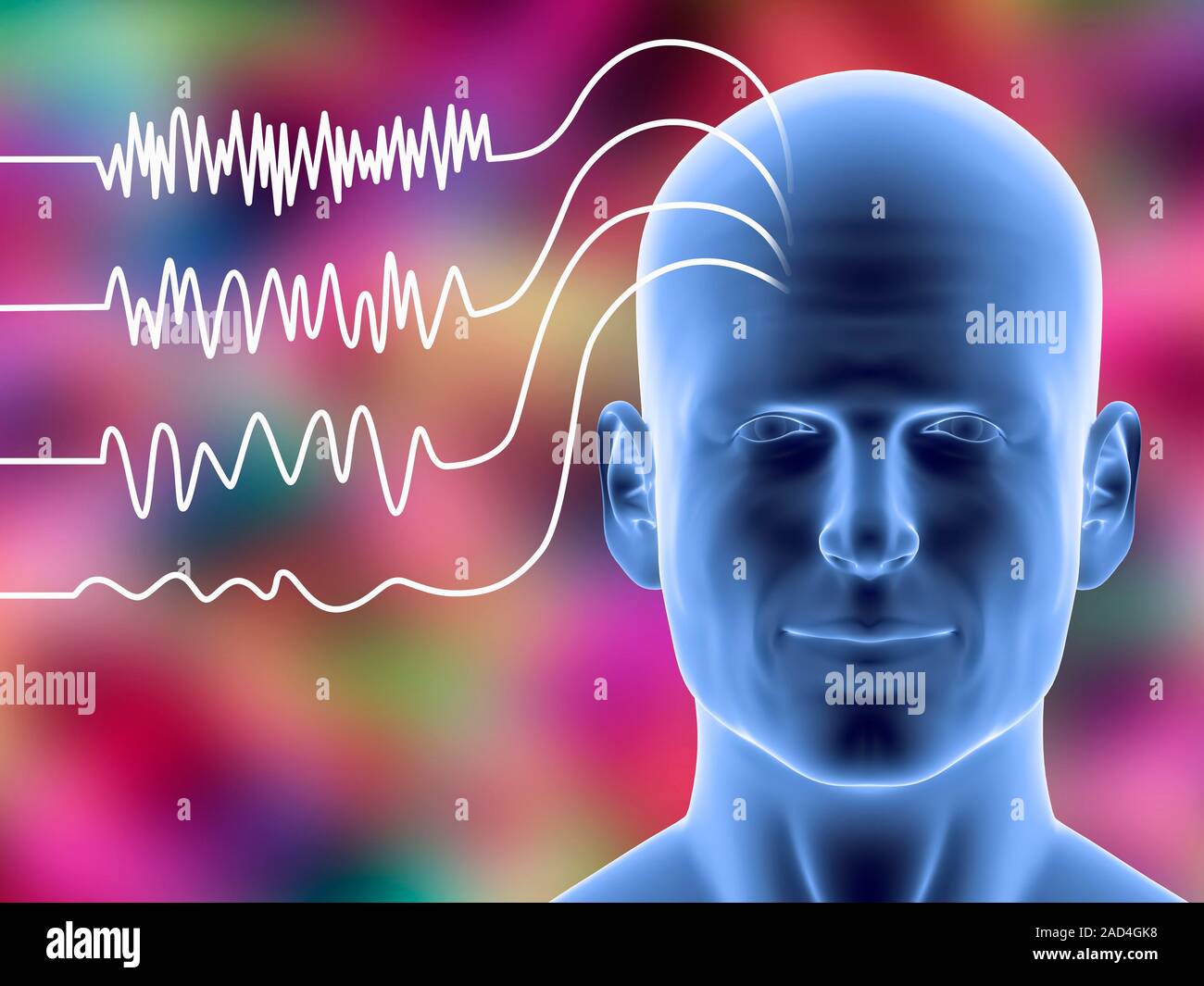 Neurofeedback (NFB), also called neurotherapy or neurobiofeedback, is a ...