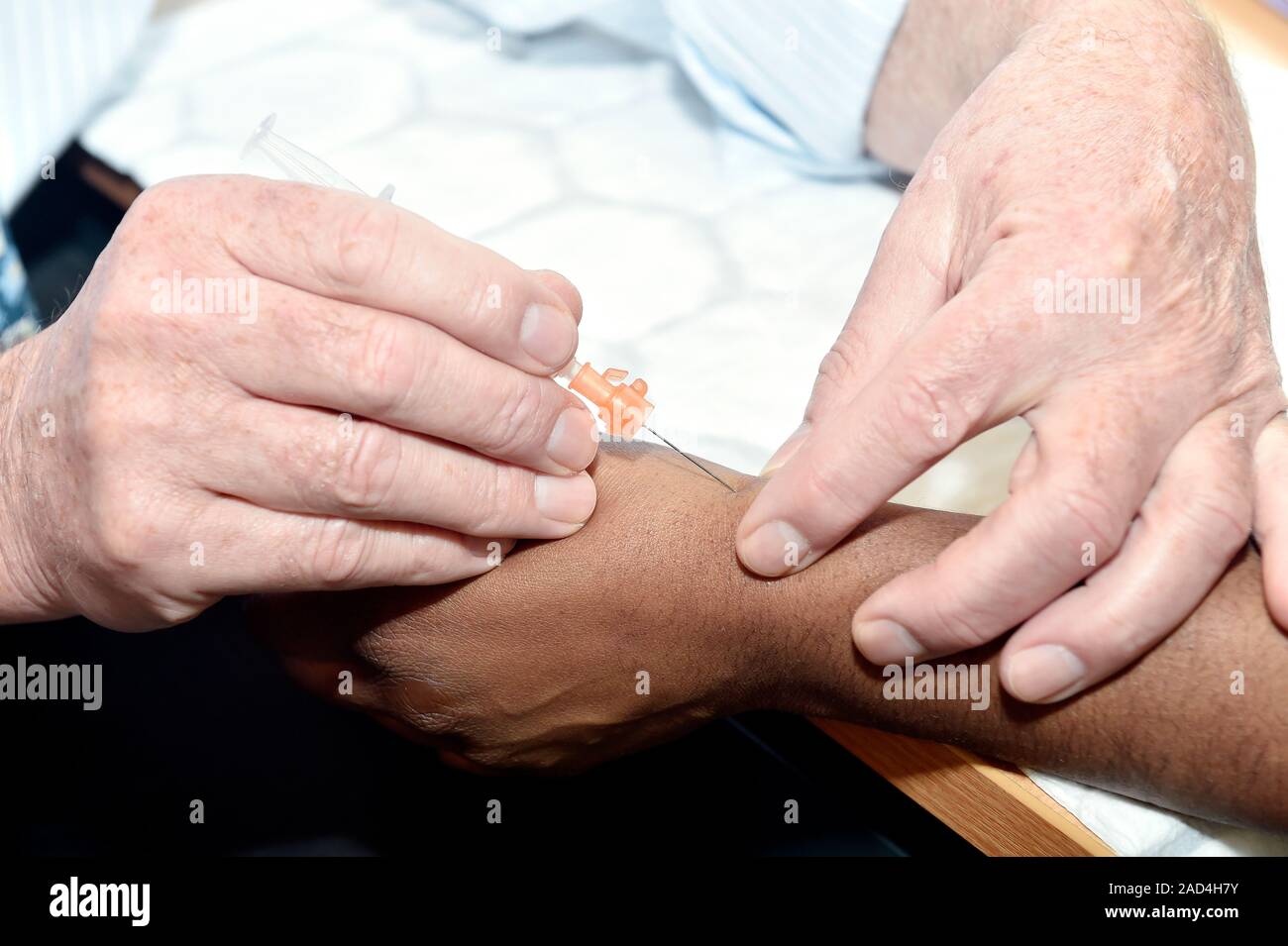 De Quervain syndrome treatment. Patient receiving a corticosteroid ...