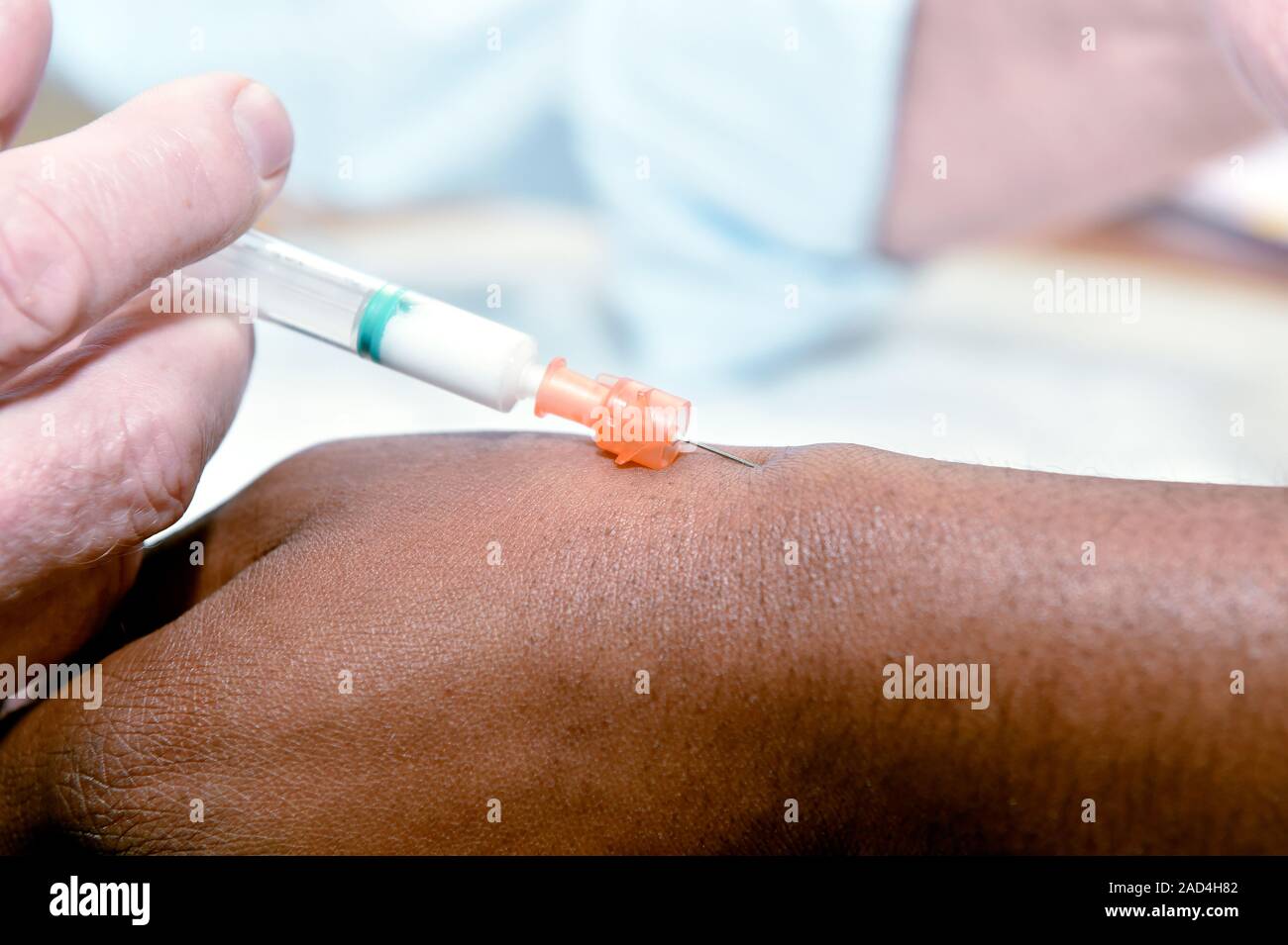 De Quervain syndrome treatment. Patient receiving a corticosteroid ...