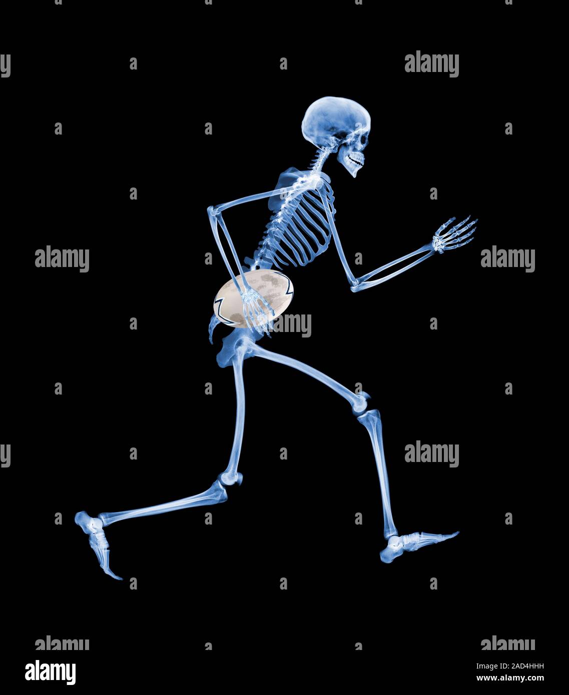 Skeleton playing rugby. Computer enhanced X-ray of a skeleton running ...