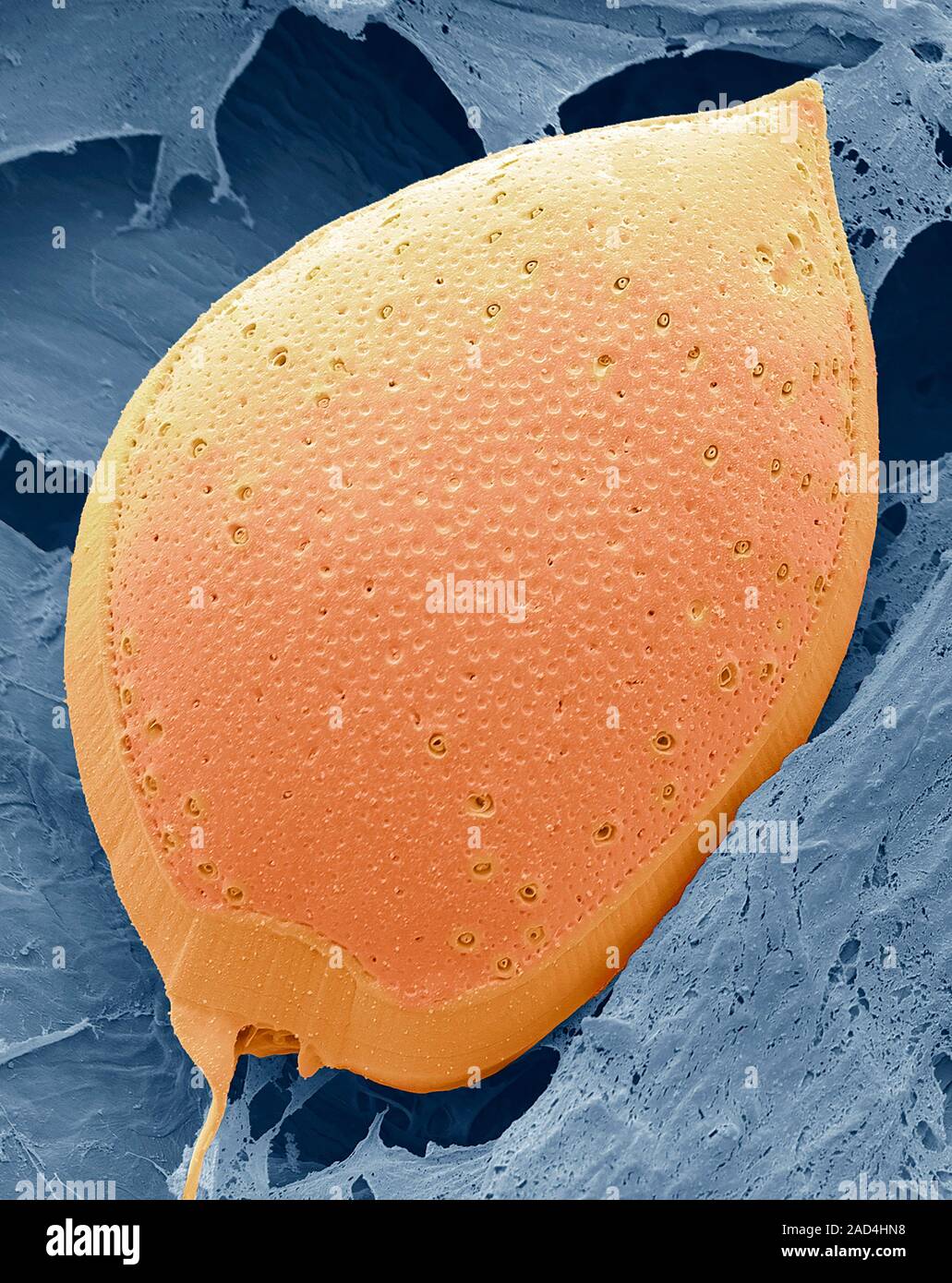 Dinoflagellate. Coloured scanning electron micrograph (SEM) of the ...