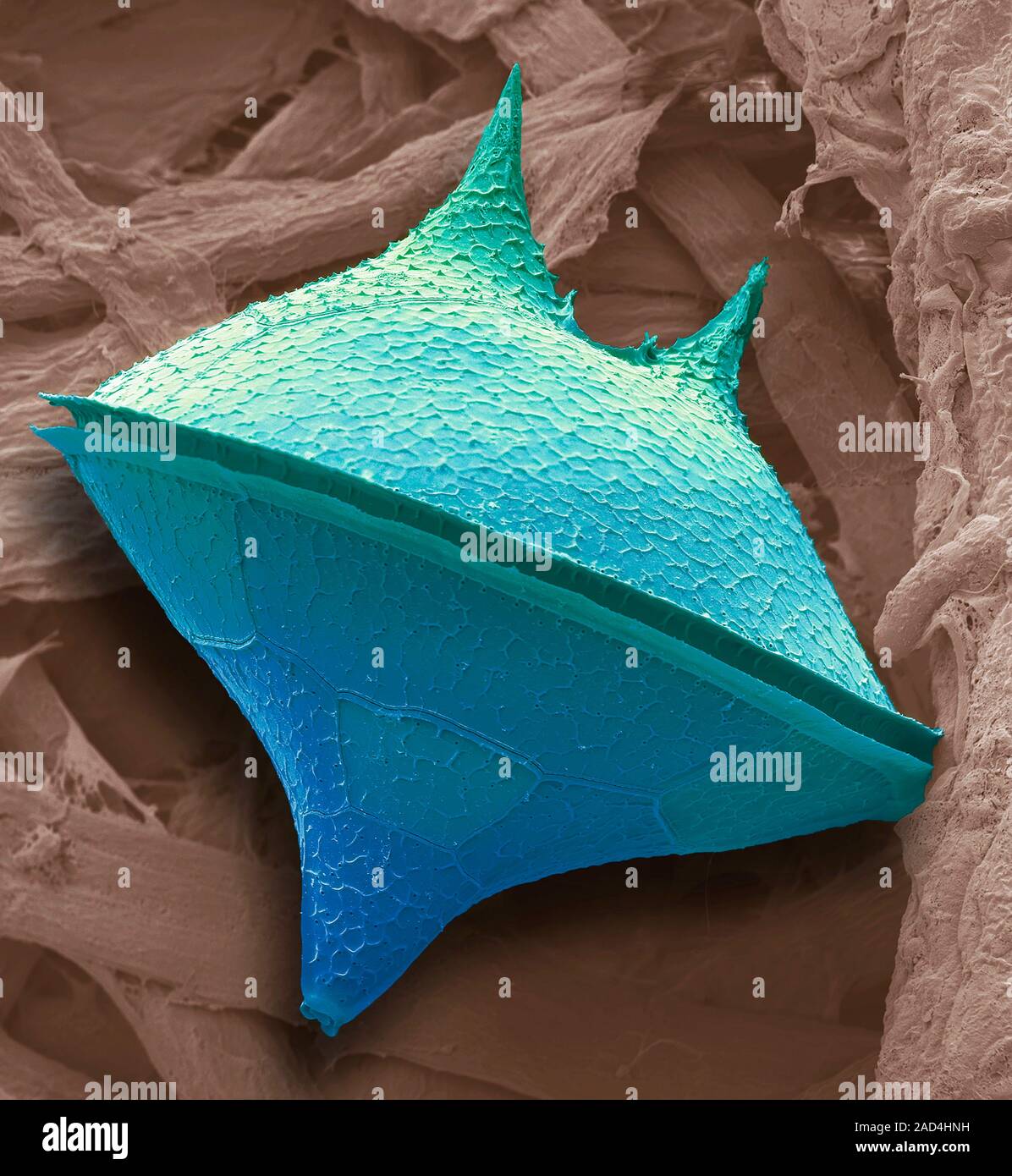 Dinoflagellate protozoan. Coloured scanning electron micrograph (SEM ...