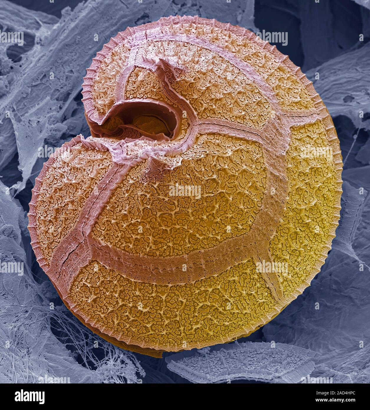 Dinoflagellate protozoan. Coloured scanning electron micrograph (SEM) of a Protoperidinium ...