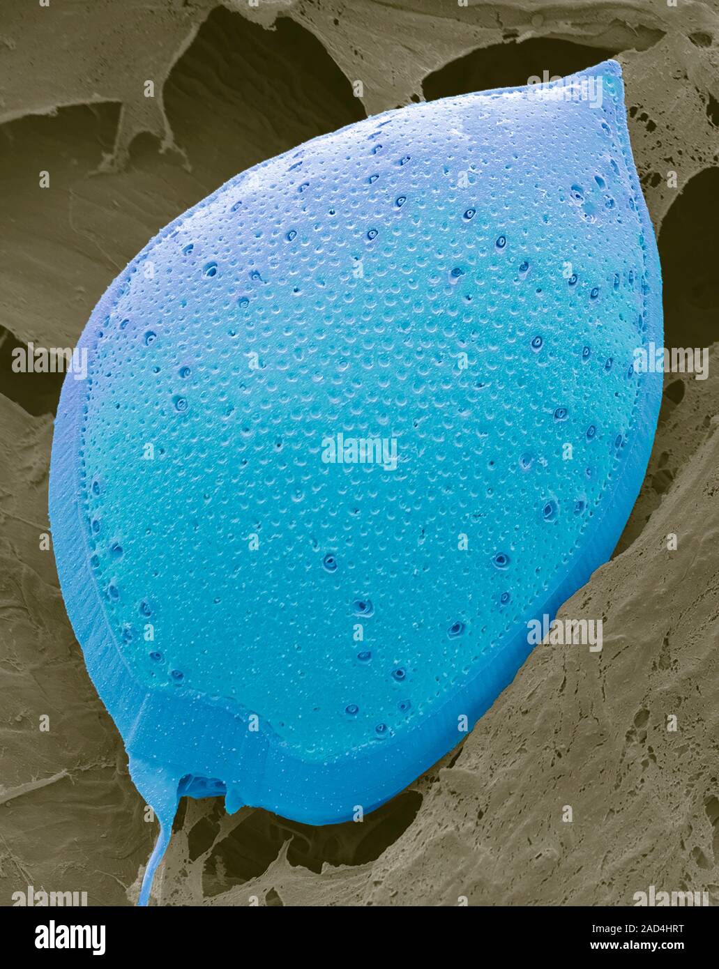 Dinoflagellate. Coloured scanning electron micrograph (SEM) of the ...