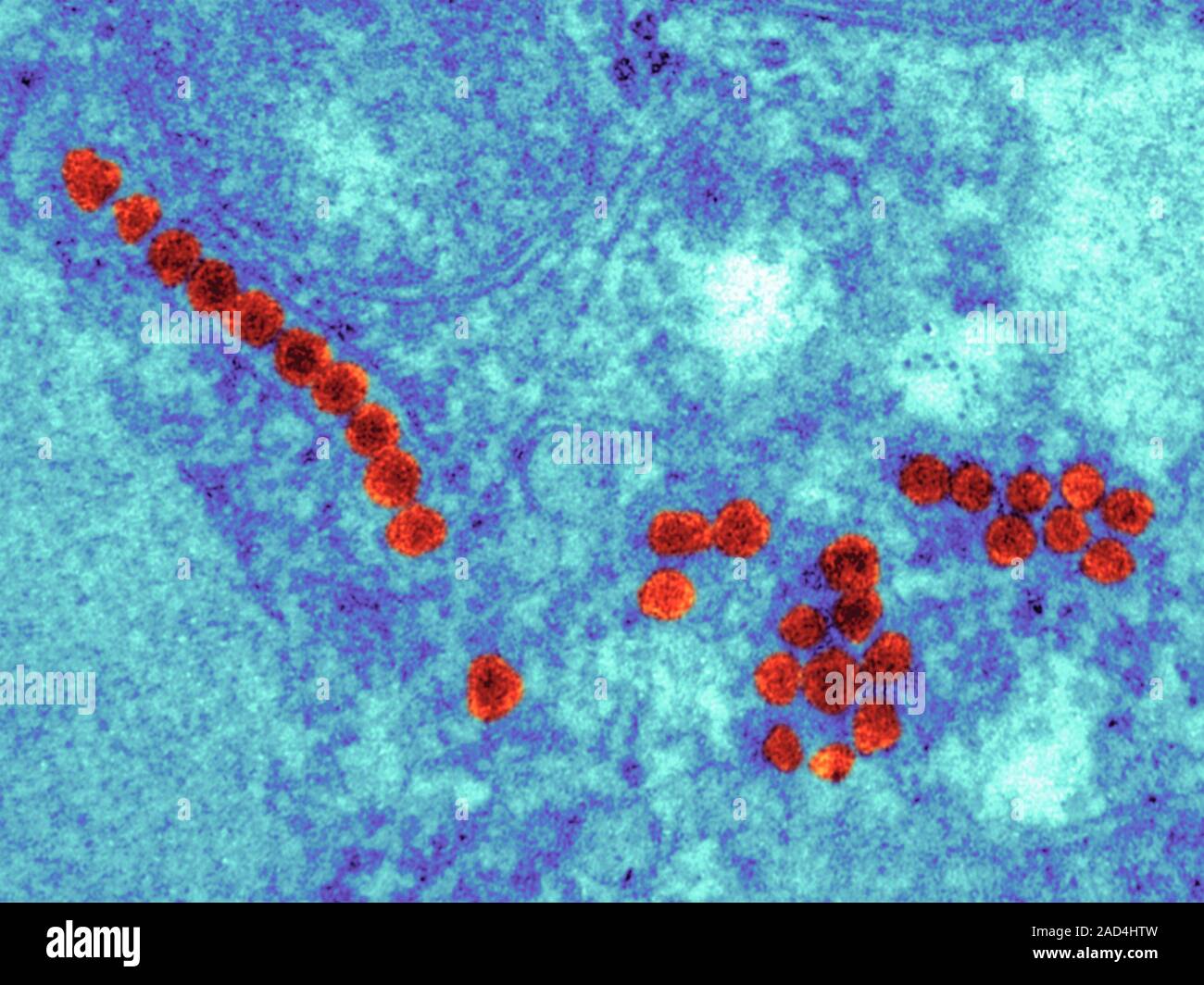 Zika virus particles, coloured transmission electron micrograph (TEM ...