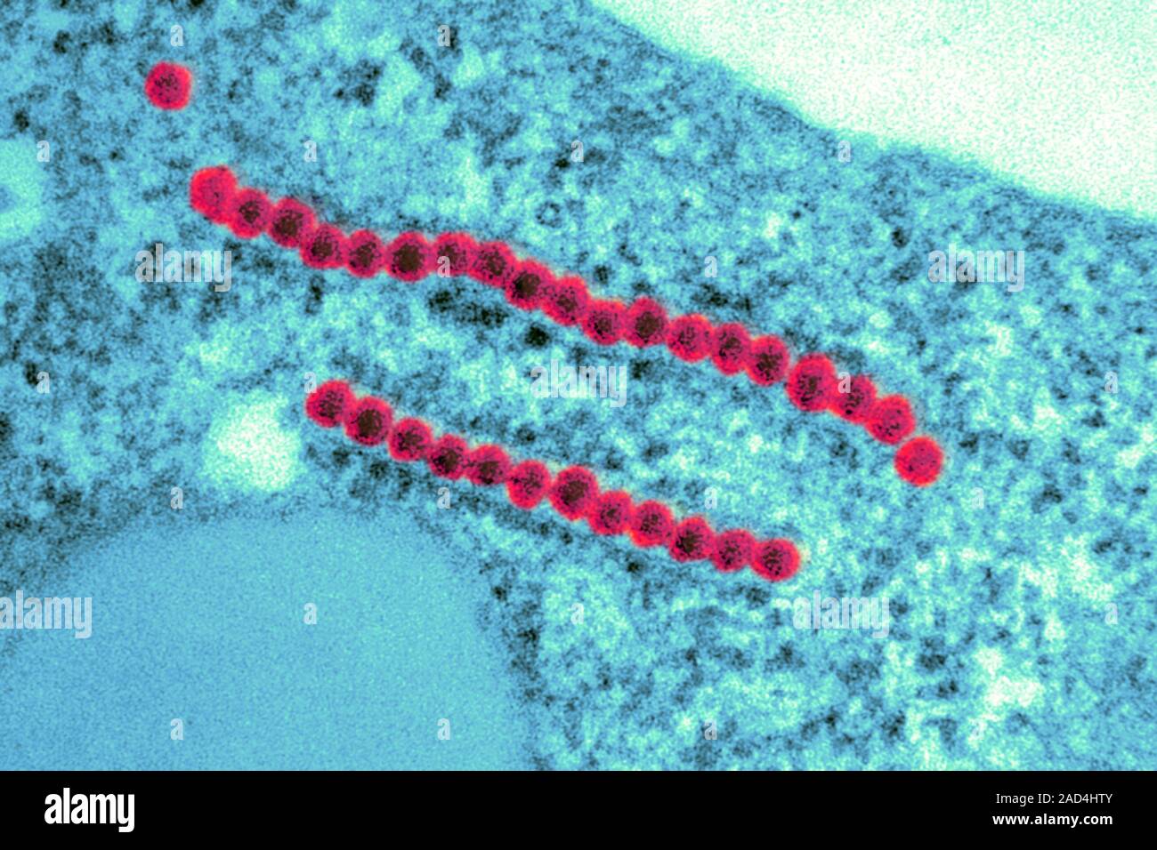 Zika virus particles, coloured transmission electron micrograph (TEM ...