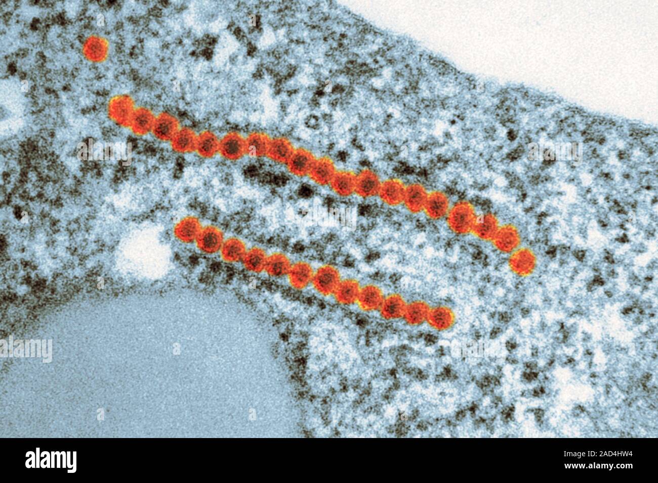 Zika virus particles, coloured transmission electron micrograph (TEM ...