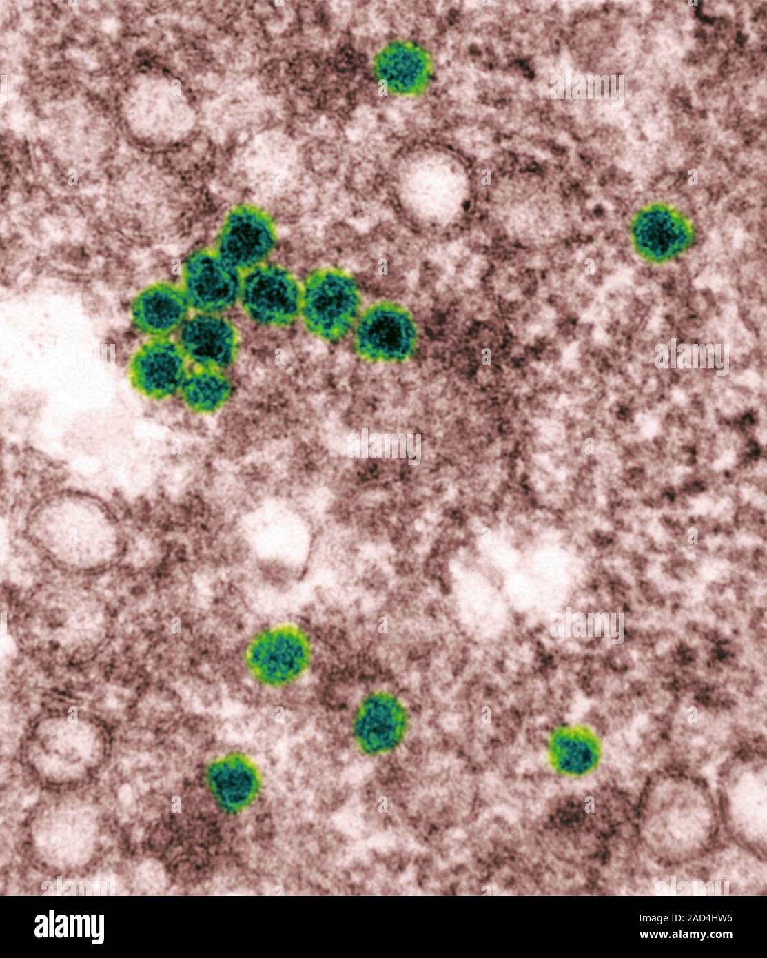 Zika virus particles, coloured transmission electron micrograph (TEM ...