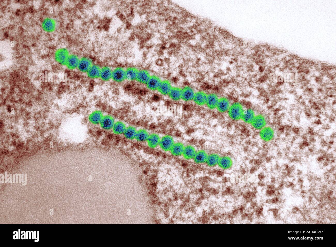 Zika virus particles, coloured transmission electron micrograph (TEM ...