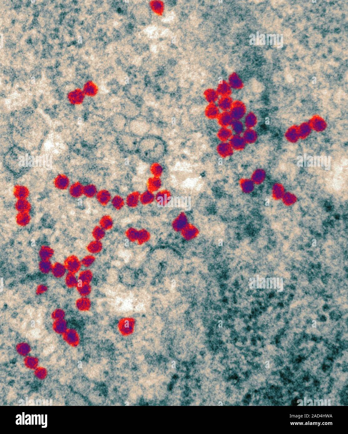 Zika virus particles, coloured transmission electron micrograph (TEM ...