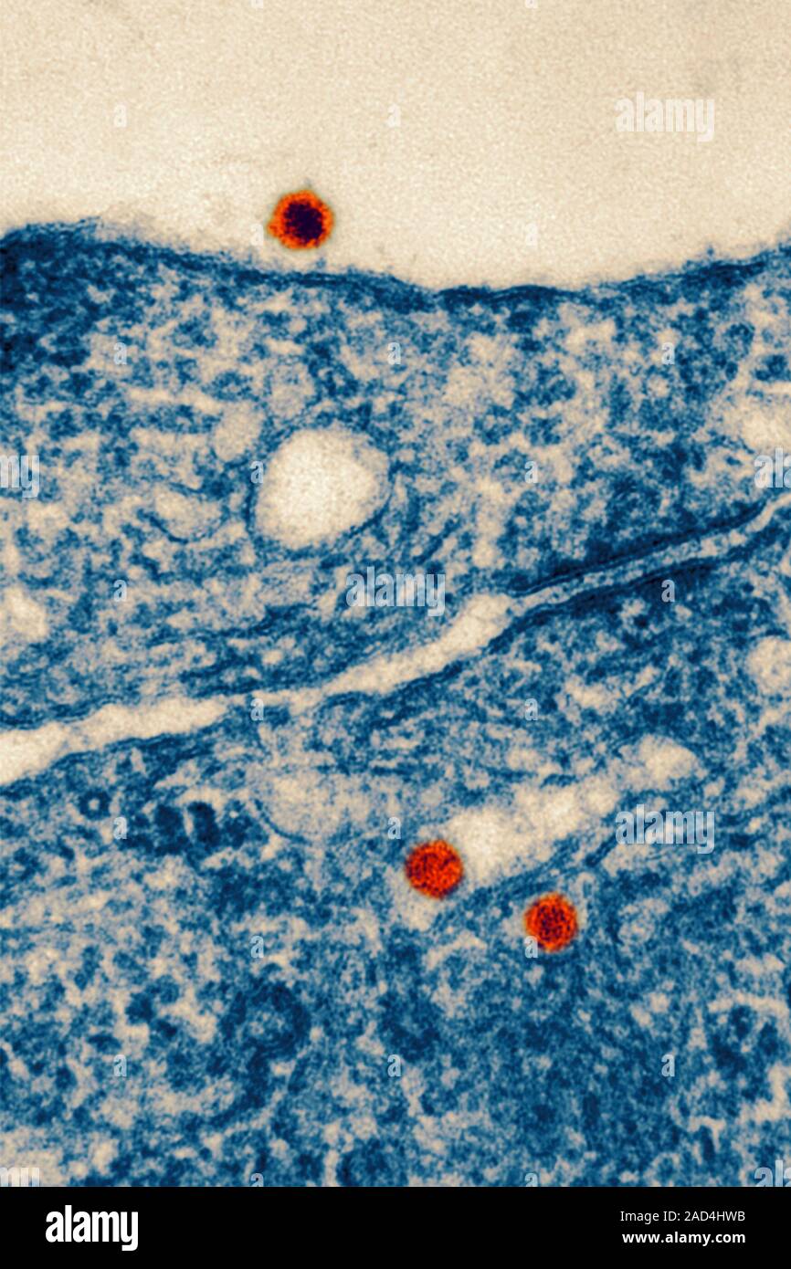 Zika virus particles (orange), coloured transmission electron ...
