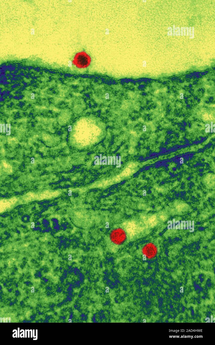 Zika virus particles (red), coloured transmission electron micrograph ...