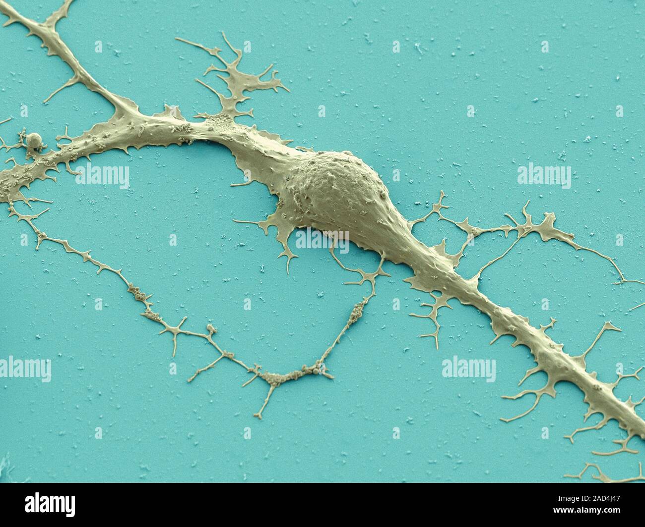 Stem cell-derived neuron. Coloured scanning electron micrograph (SEM ...
