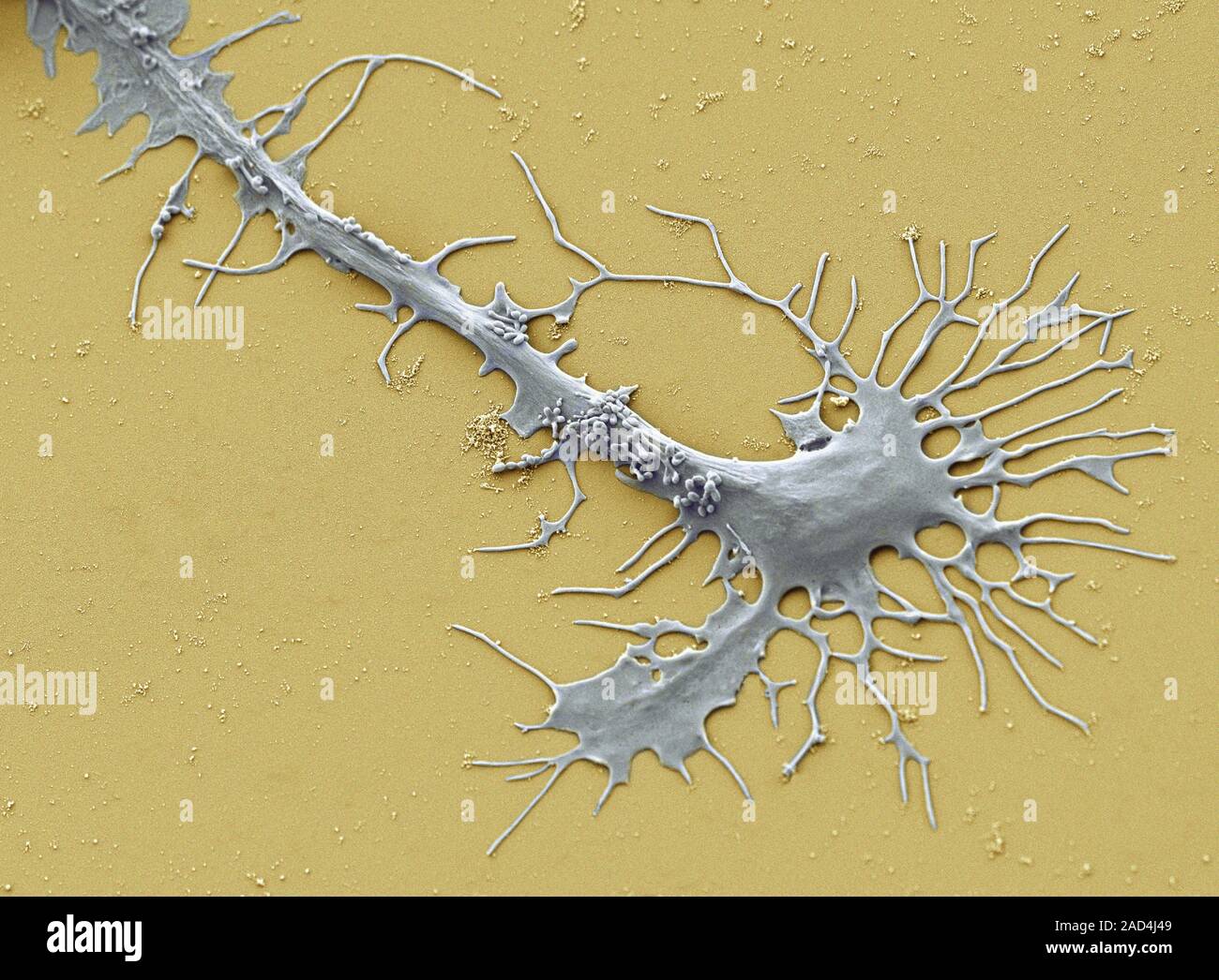 Nerve Cells Coloured Scanning Electron Micrograph Sem