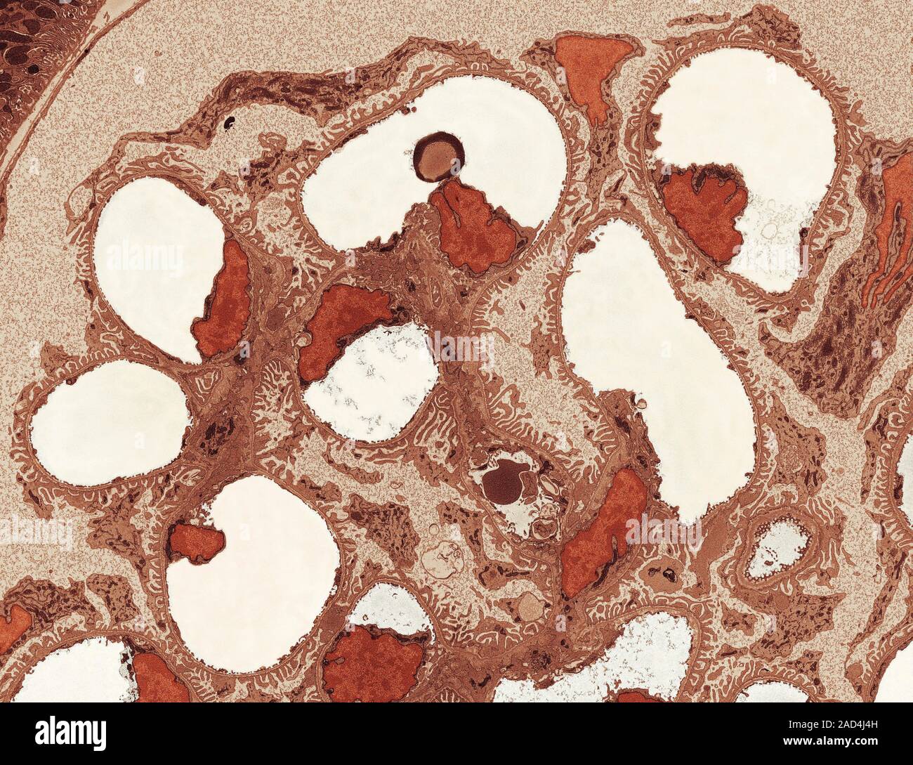 Kidney glomerulus. Coloured scanning transmission micrograph (TEM) of a ...