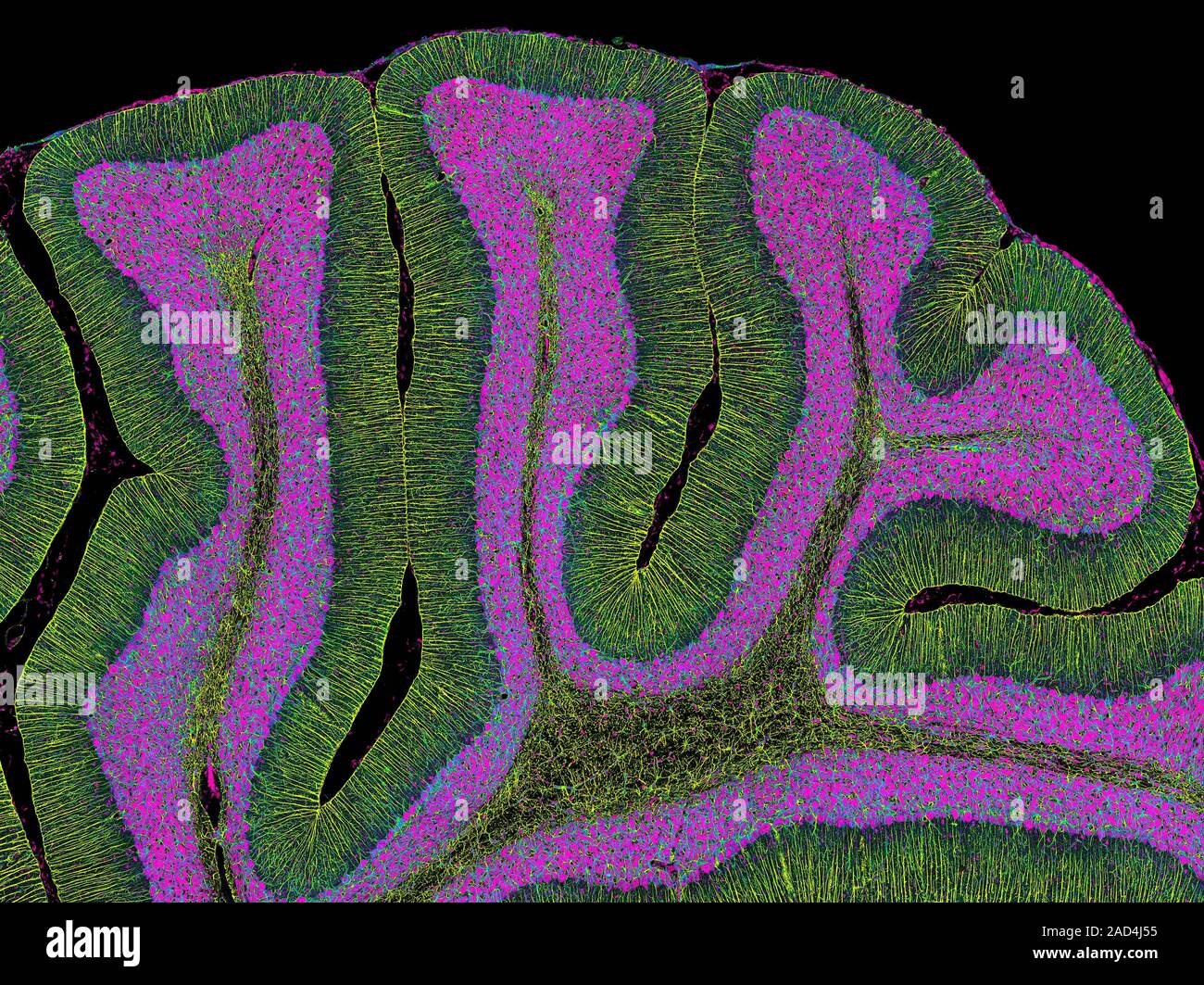 Cerebellum from a brain. Multiphoton fluorescence micrograph (MFM) of a ...