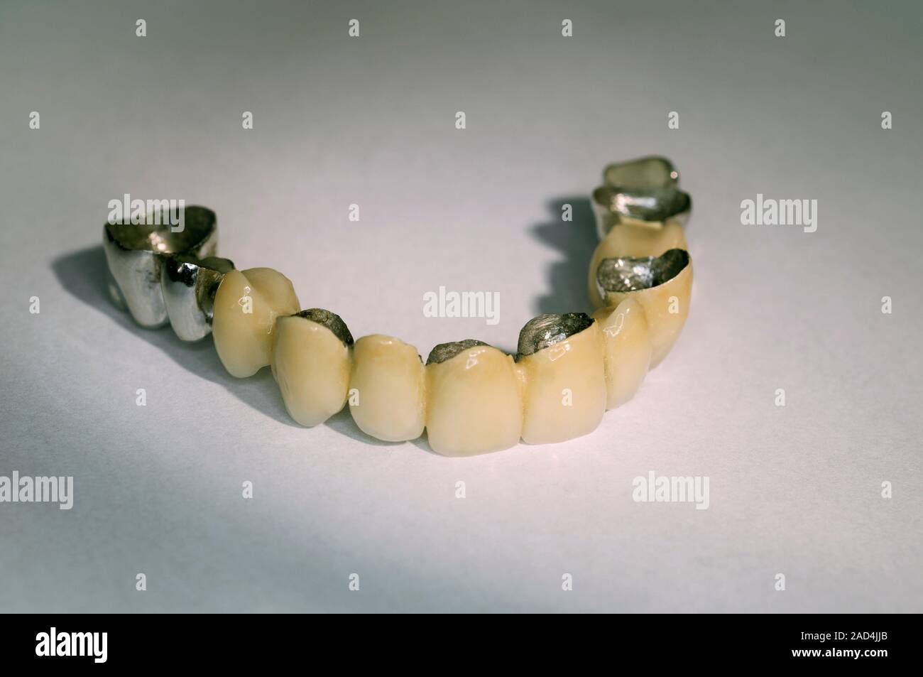 Metal Ceramic Bridge