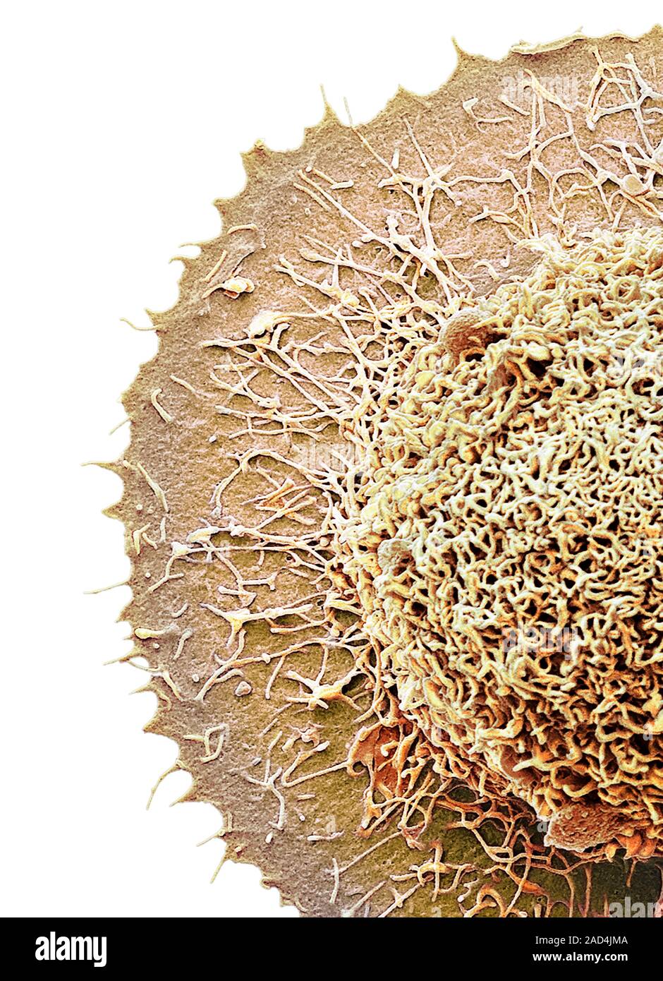 Colorectal Cancer Cell Coloured Scanning Electron Micrograph Sem Of