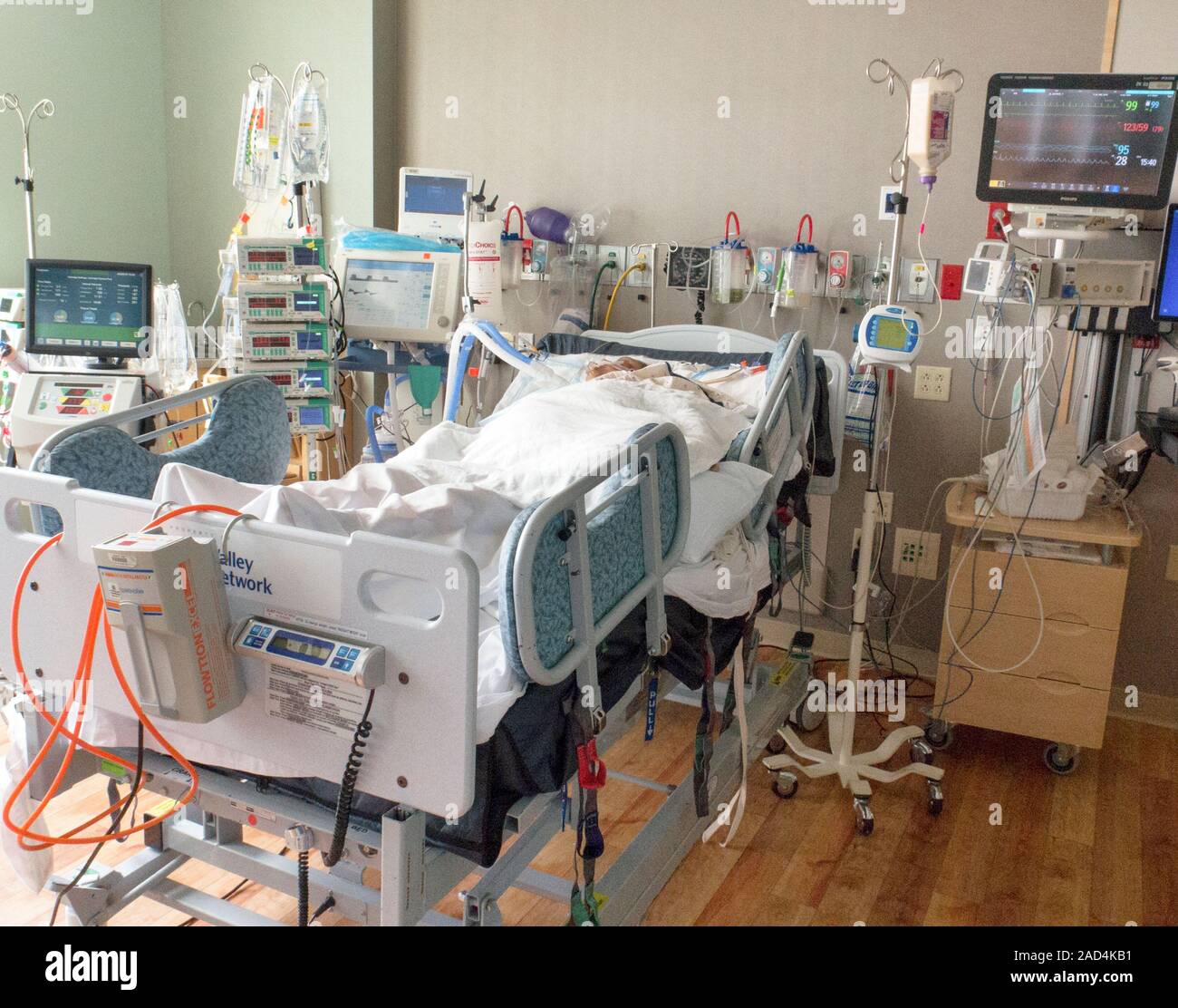 Renal patient on ventilator support. Ventilated patient in a hospital intensive care unit (ICU ...